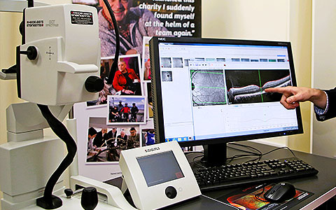 SPECTRALIS: Skills for Diabetic Eye Screening